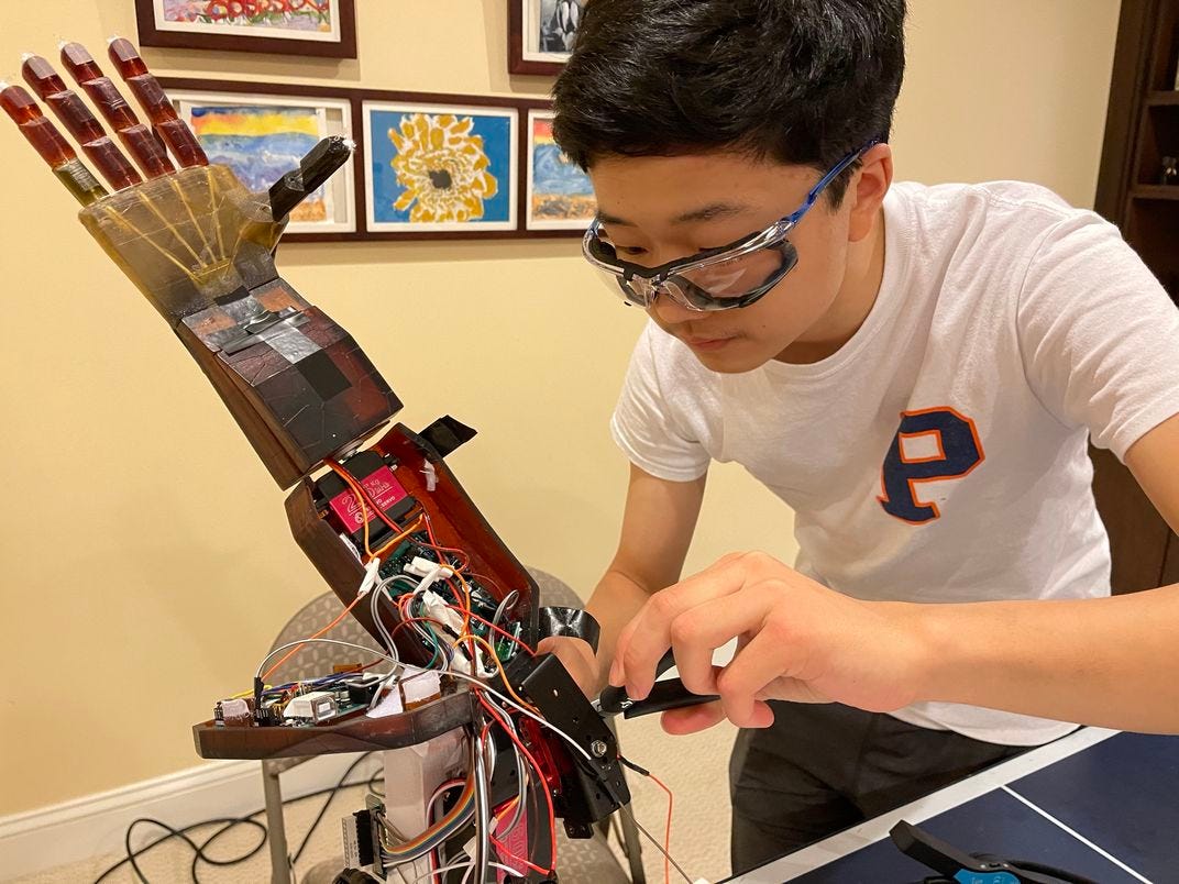 An AI Arm for Amputees. No surgery. No brain implants. Just thinking ...