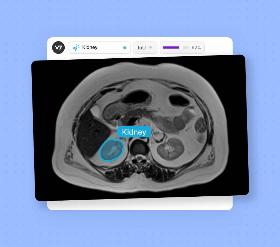 Ai Tools for Radiology: Revolutionizing Medical Imaging | by Dr Murad ... Ai Tools for Radiology: Revolutionizing Medical Imaging | by Dr Murad ...