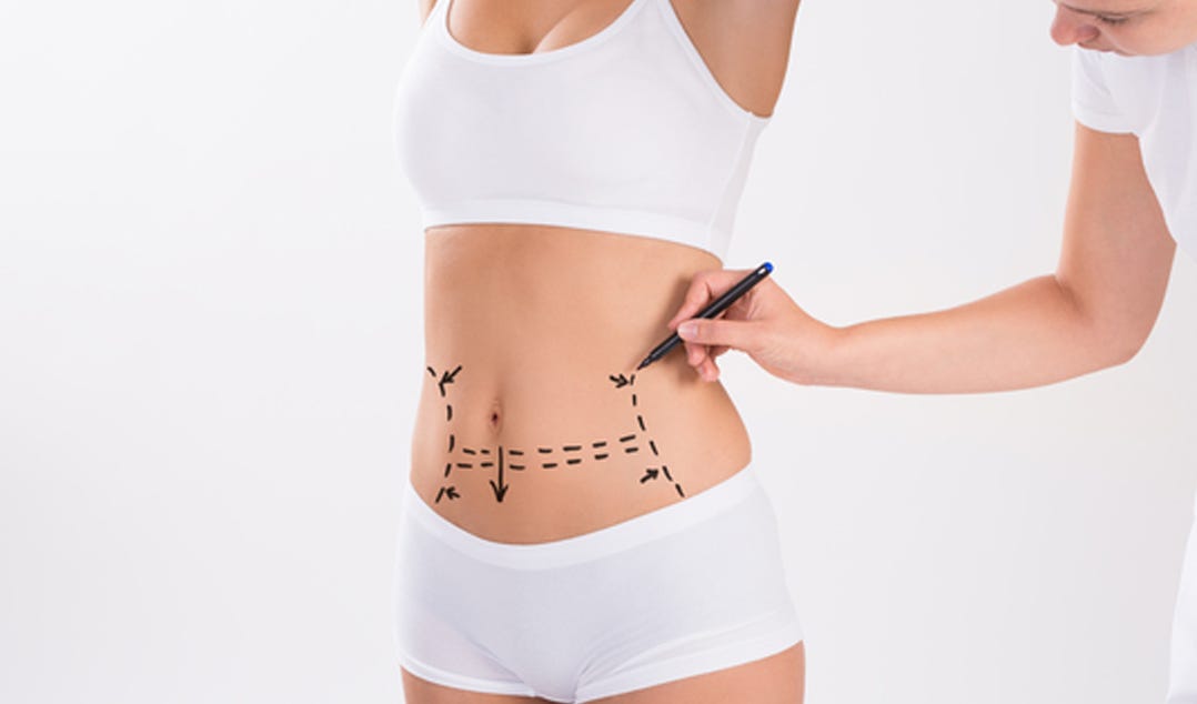 ดูดไขมัน Vaser Liposelection. ดูดไขมัน VASER ไขมัน… | by poppygfca giftgift | Medium