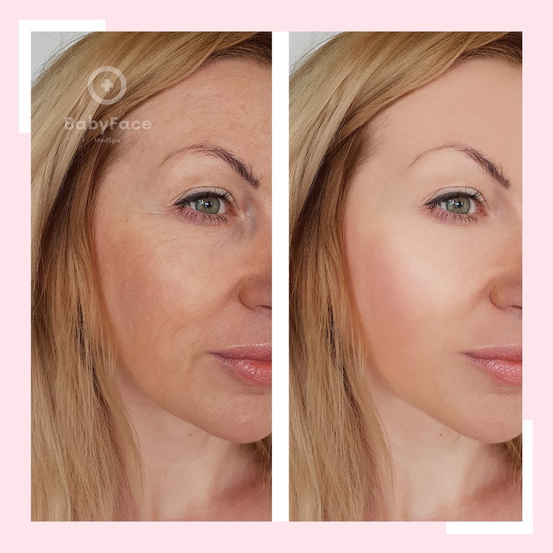 Witness the transformation of our client who decided to take the ...