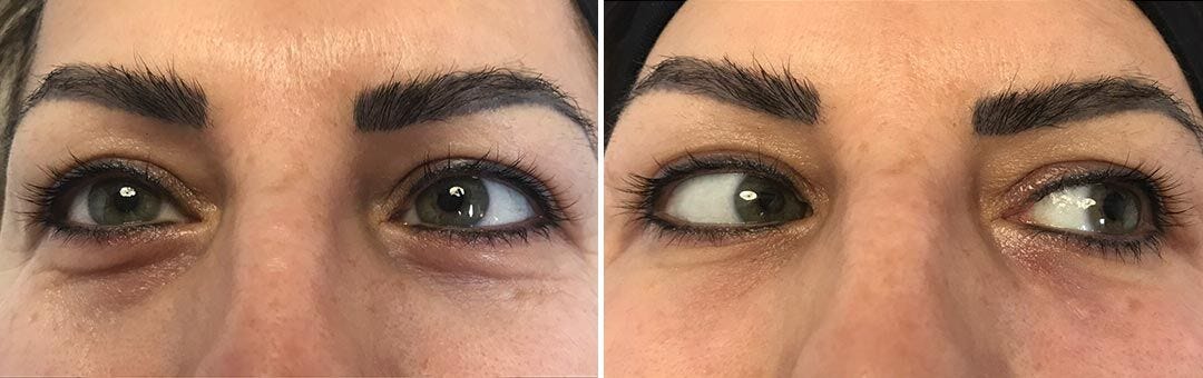 Youthful Skin Awaits: Sunekos Injections in Sydney | by Dental ...