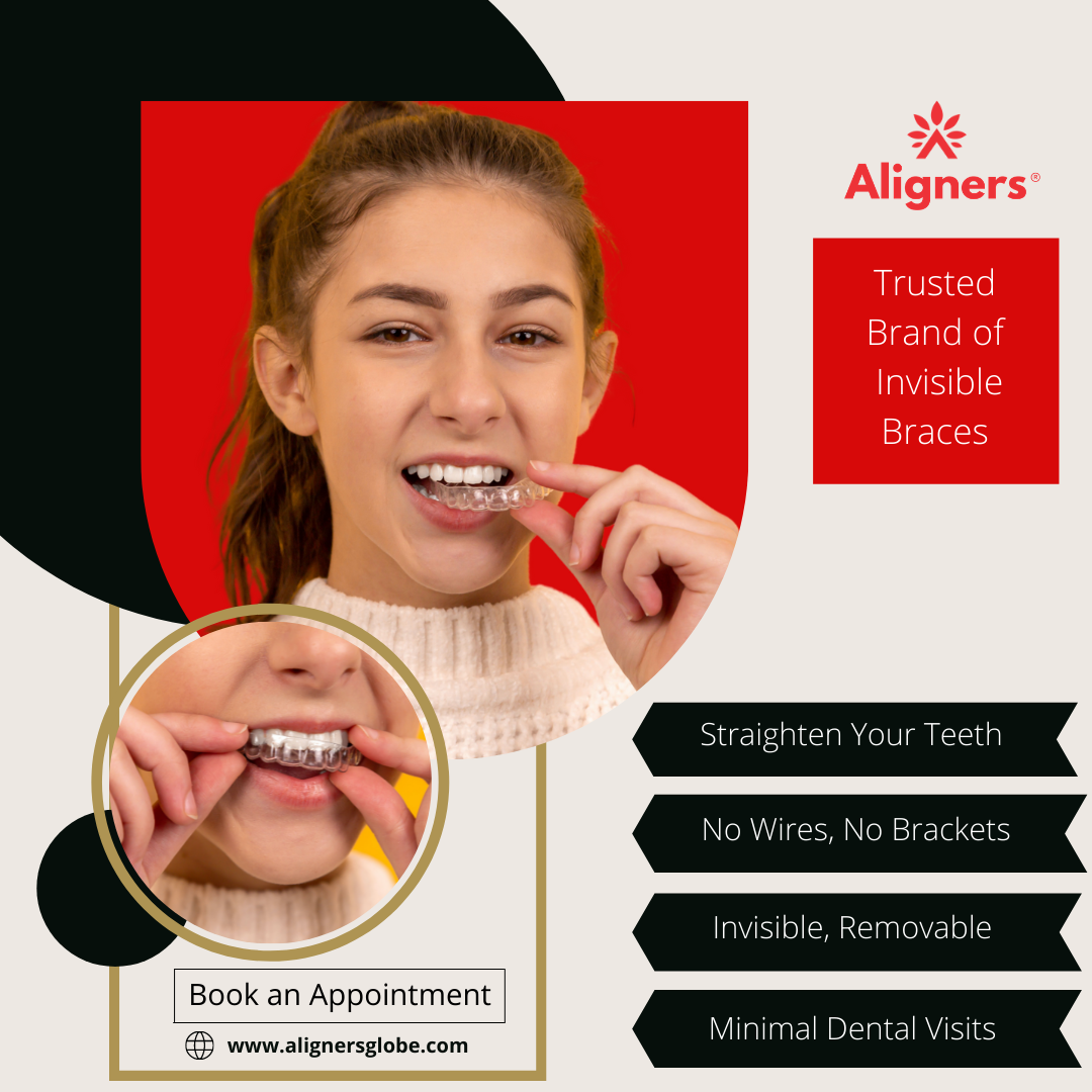 Crooked Teeth. Crooked teeth are a dental health… | by Abdul Kader | Medium