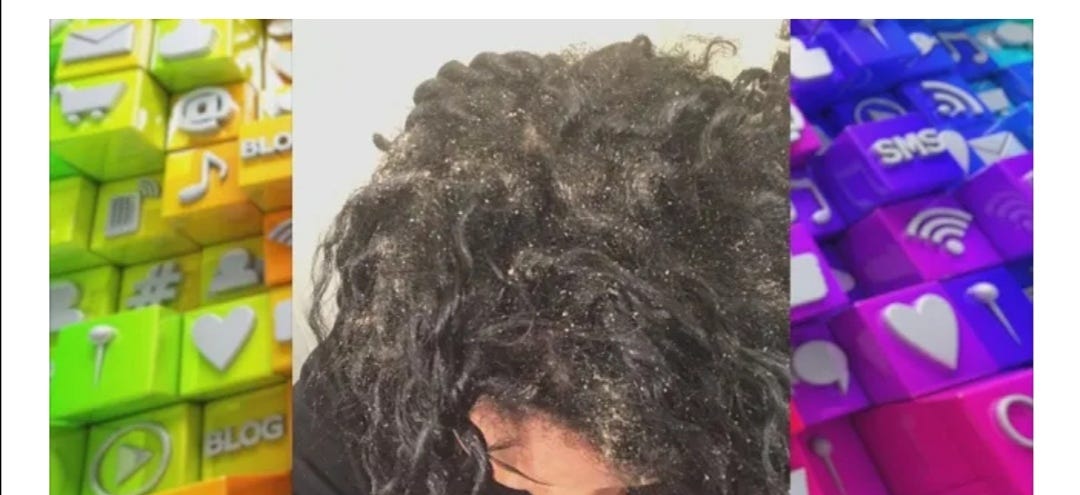 How to treat dandruff at home: 2 Final solution you should know - Alex ...