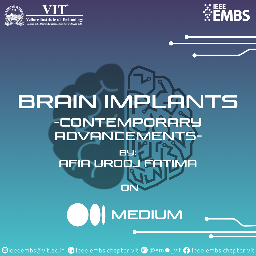 Brain Implants: Contemporary Advancements | by Afia Urooj Fatima ...