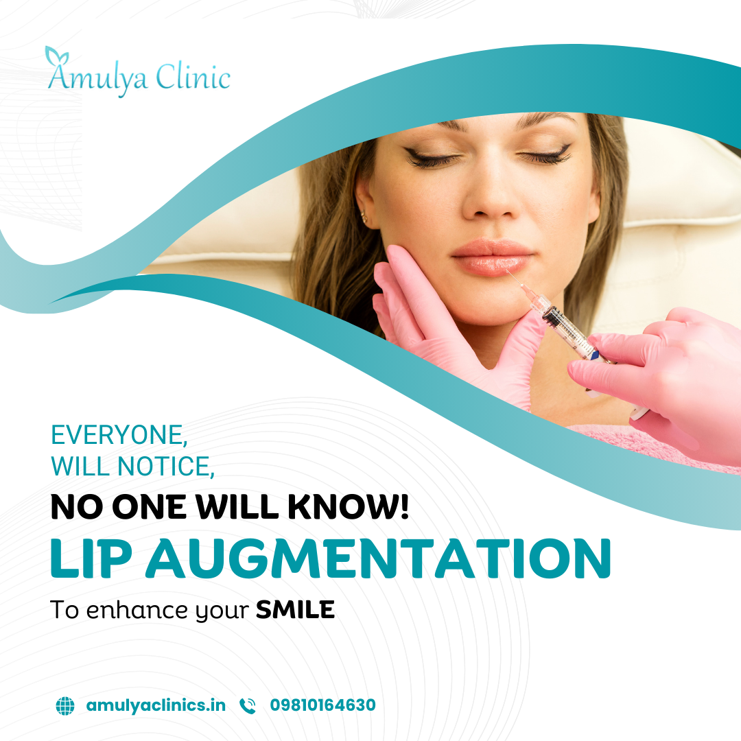 Enhance Your Look with Lip Augmentation | Best Cosmetic Surgery | by ...