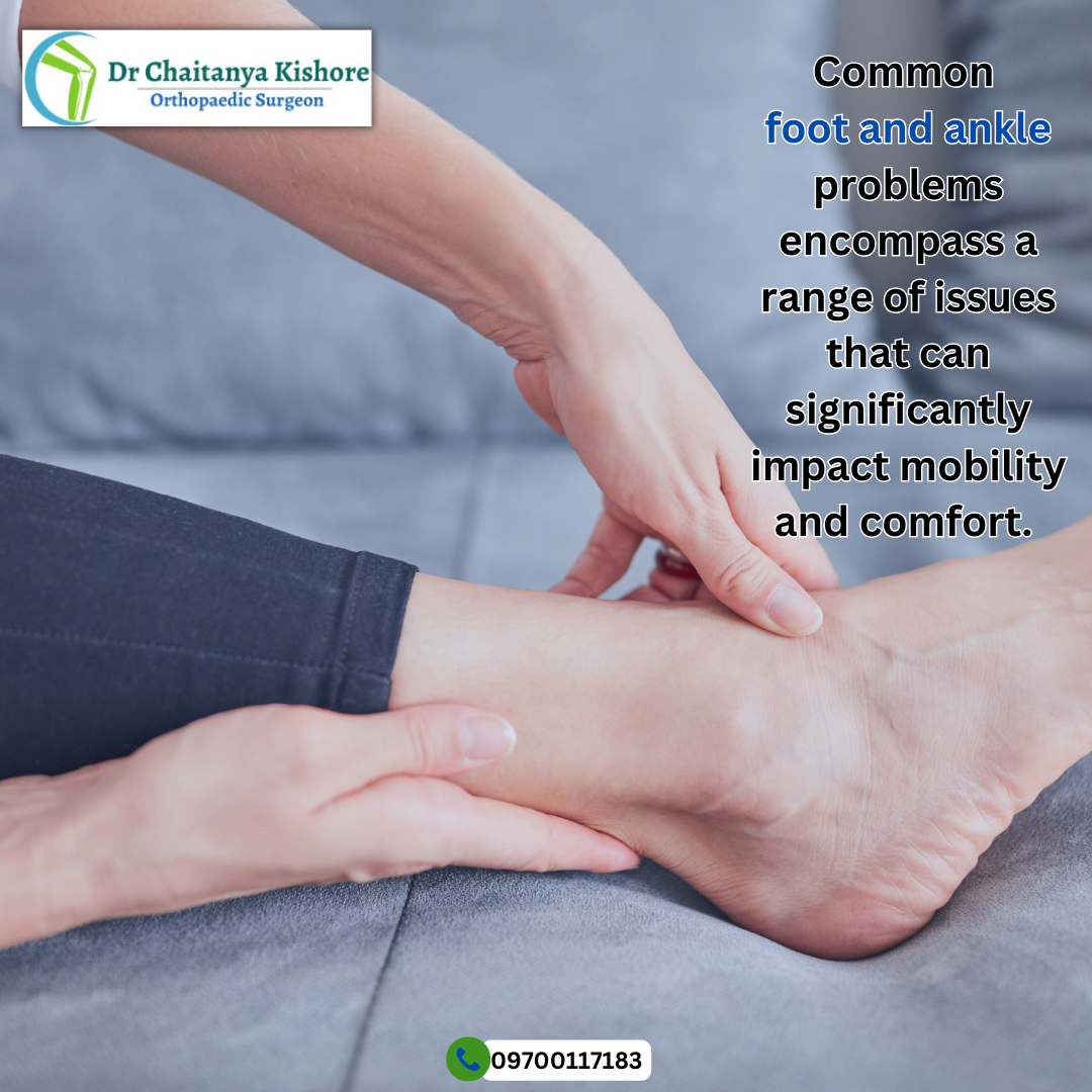 Foot And Ankle Problems. Foot and ankle problems can… | by ...