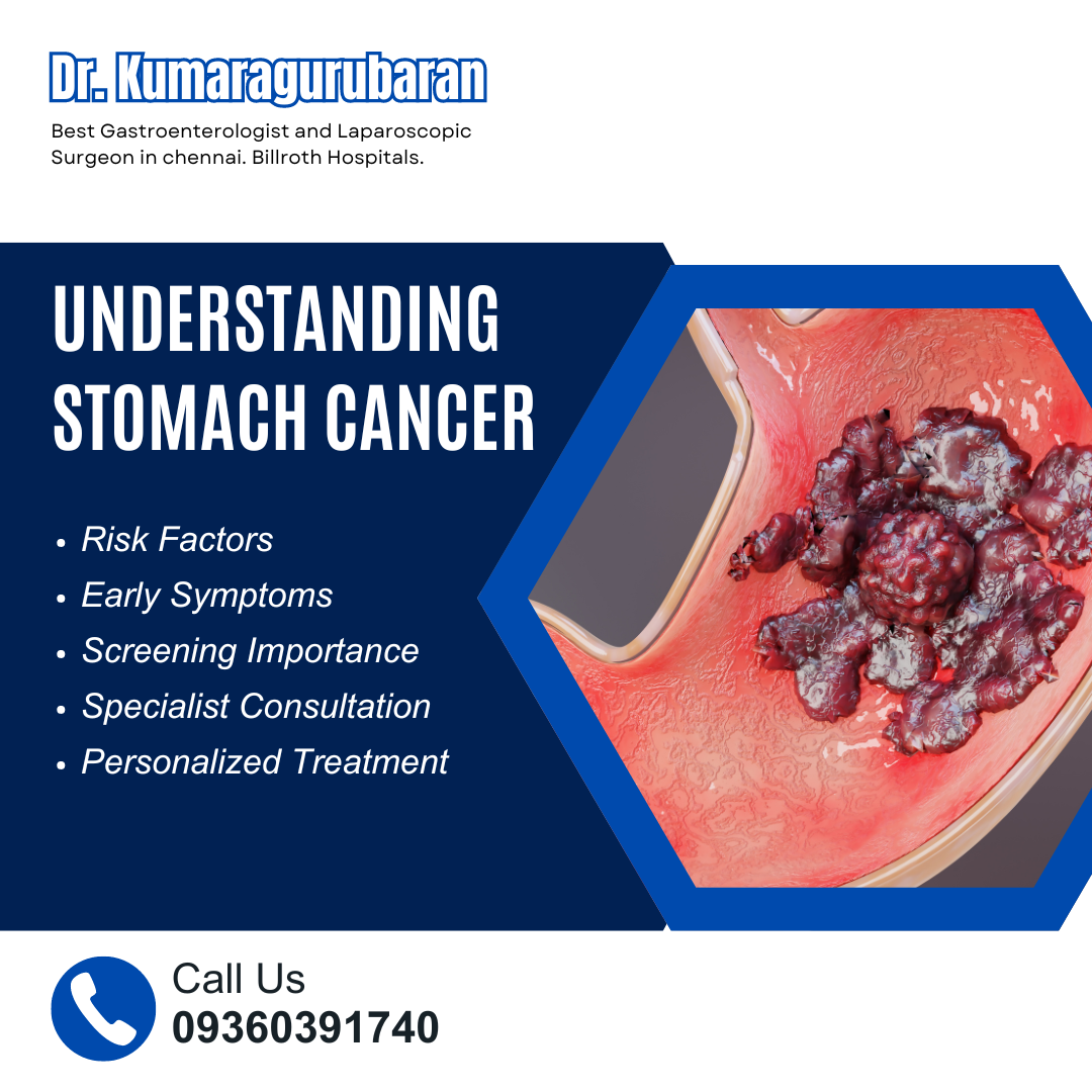 Understanding Stomach Cancer: Symptoms, Causes, and Treatment | Best ...