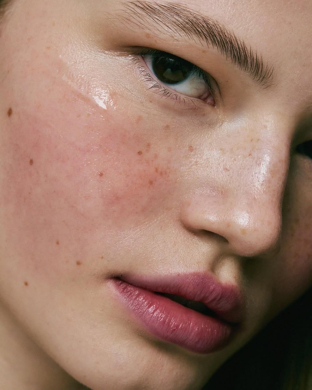 Why Skin Is the Biggest Factor in Attractiveness | Medium
