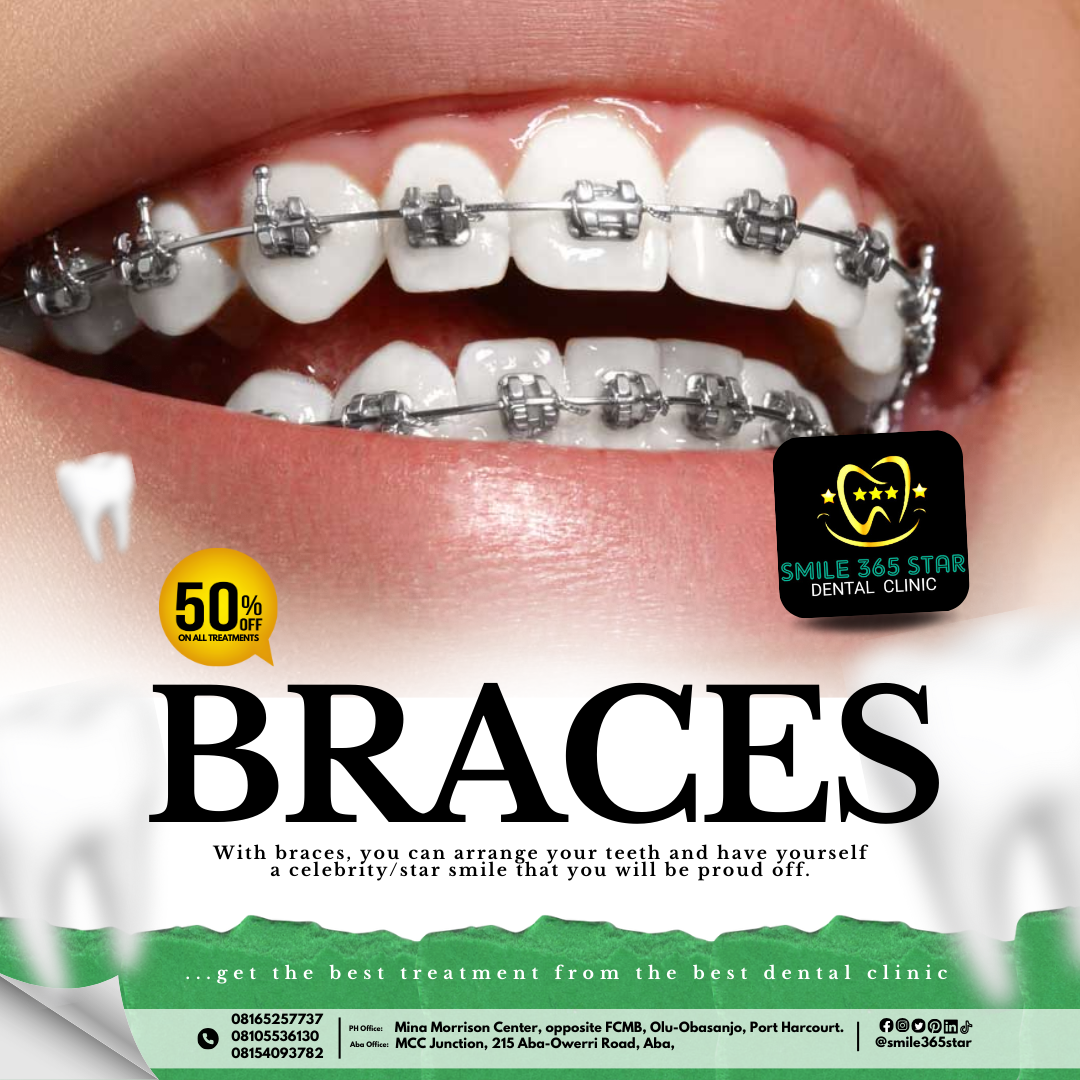 Braces, Invisalign And Clear Braces From Smile 365 Star Dental Clinic ...