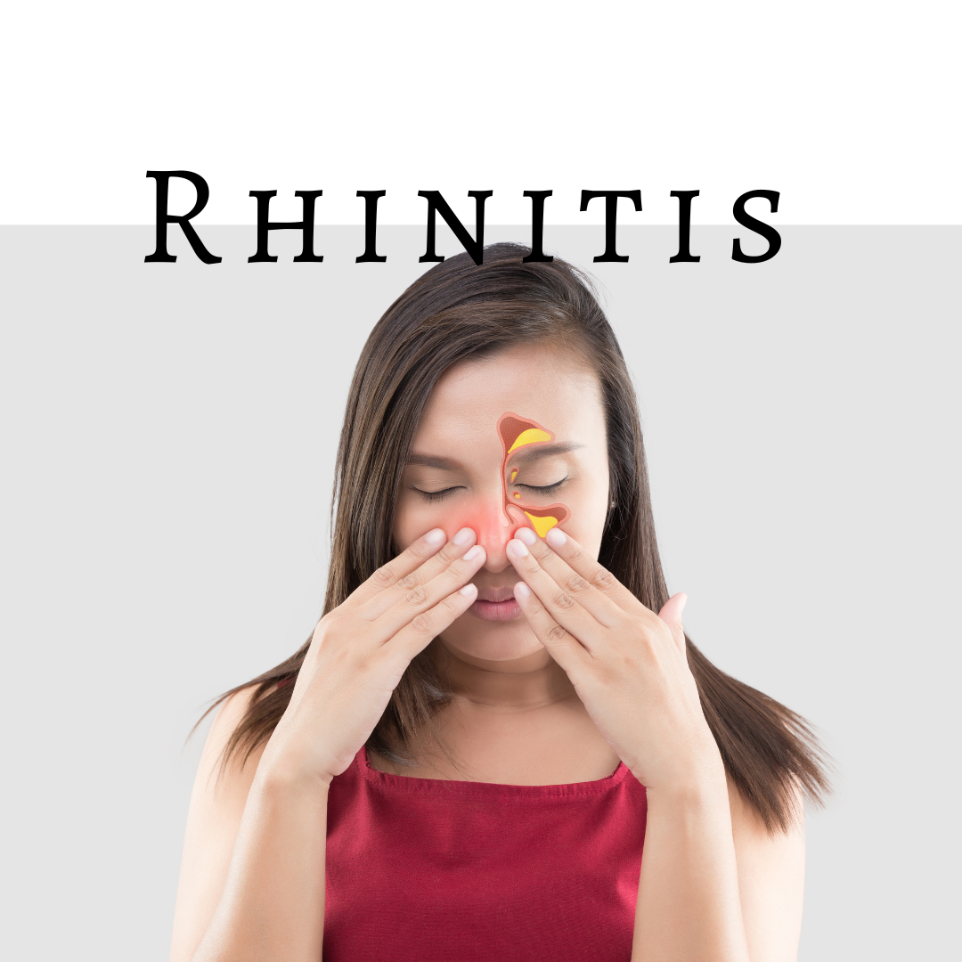 Allergic Rhinitis (Hay Fever). Allergic rhinitis is also called Hay… | by Spirals Health | Medium