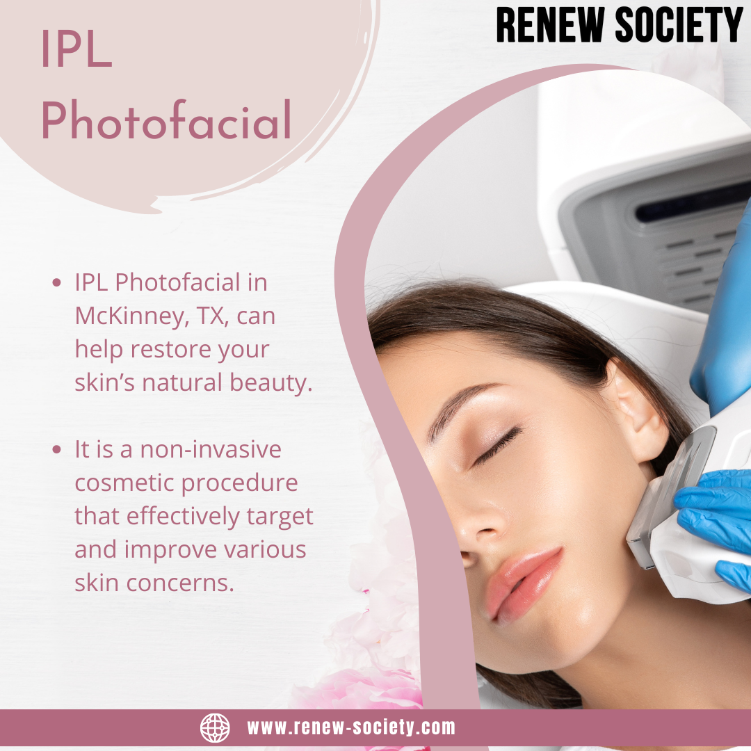 Say Goodbye to Skin Imperfections with IPL Photofacial in McKinney, TX | by Jshree | Jun, 2023 ...