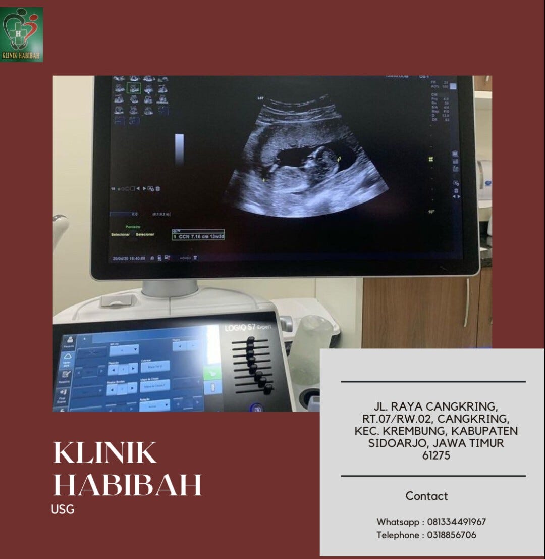 PELAYANAN RAMAH, wa 0813-3449-1967, Melayani Usg Fetomaternal Klinik ...