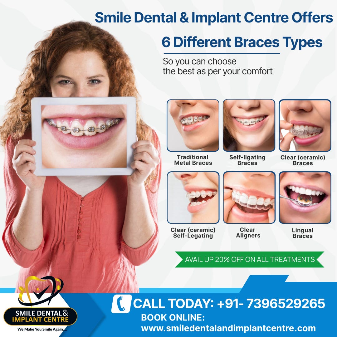 6 Braces Choices to Transform Your Smile | Smile Dental and Implant Centre | by Smile Dental ...