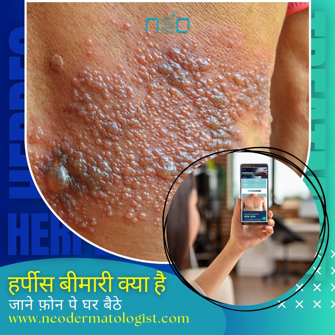 Best online skin doctor consultation free - neodermatologist - Medium