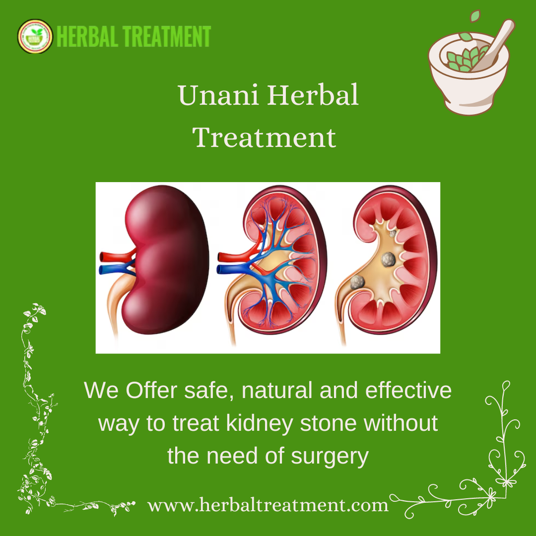 Unani Kidney Stone Treatment - Infoselva - Medium