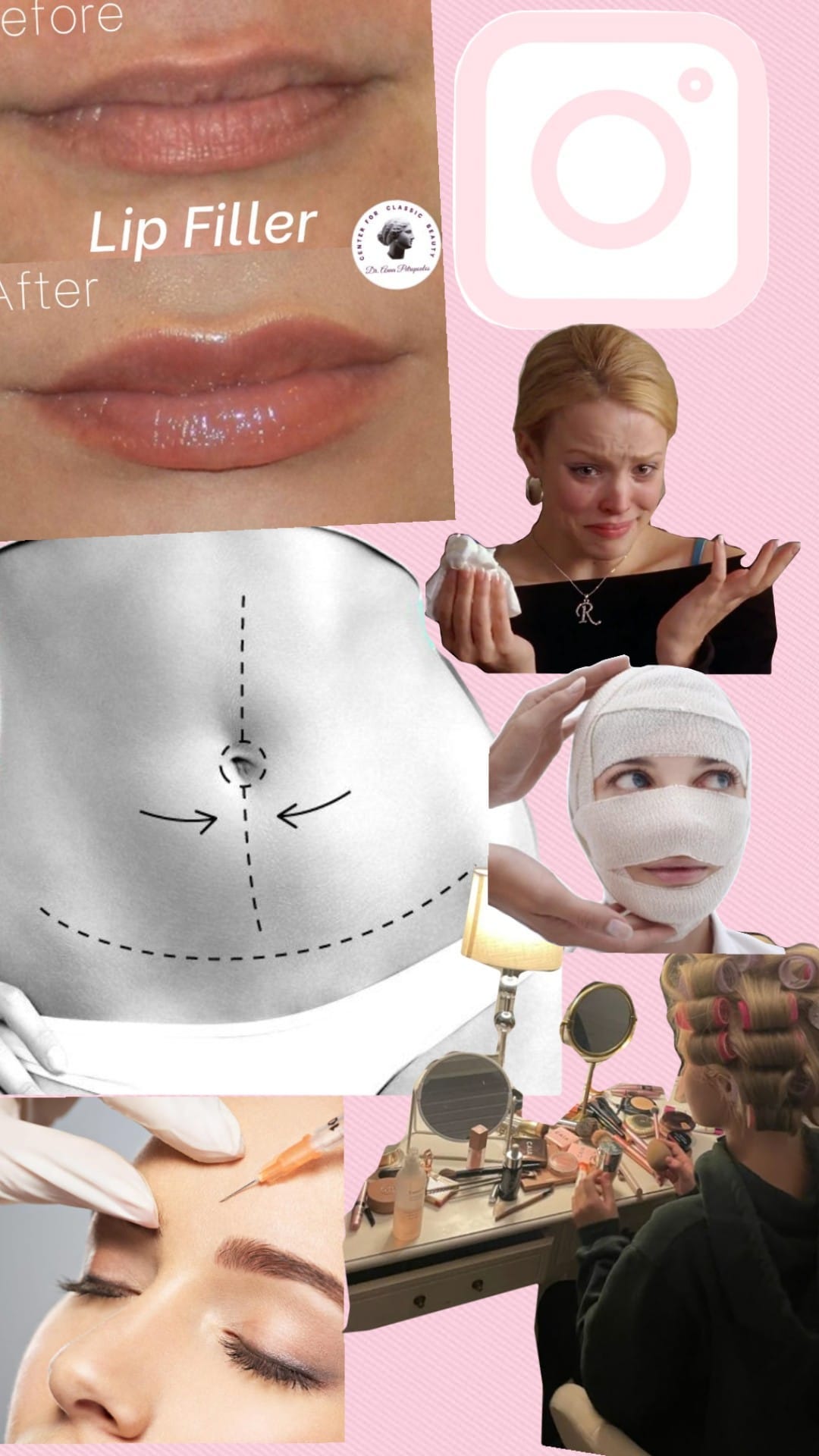 Fillers, filters and Instagram face: The pandemic of looking the Same ...