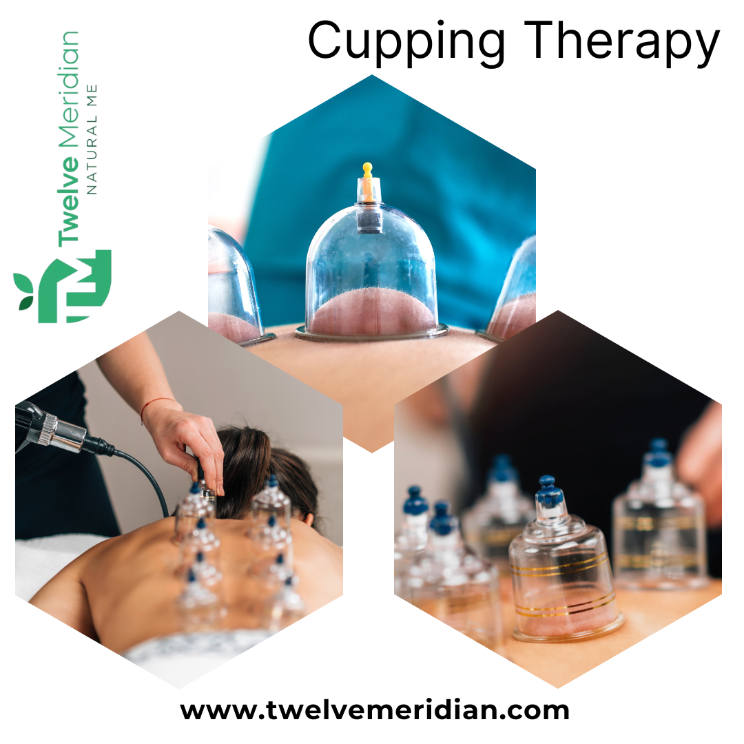 Leading Cupping Therapy Centre in Sector 33 of Noida - Twelvemeridian ...
