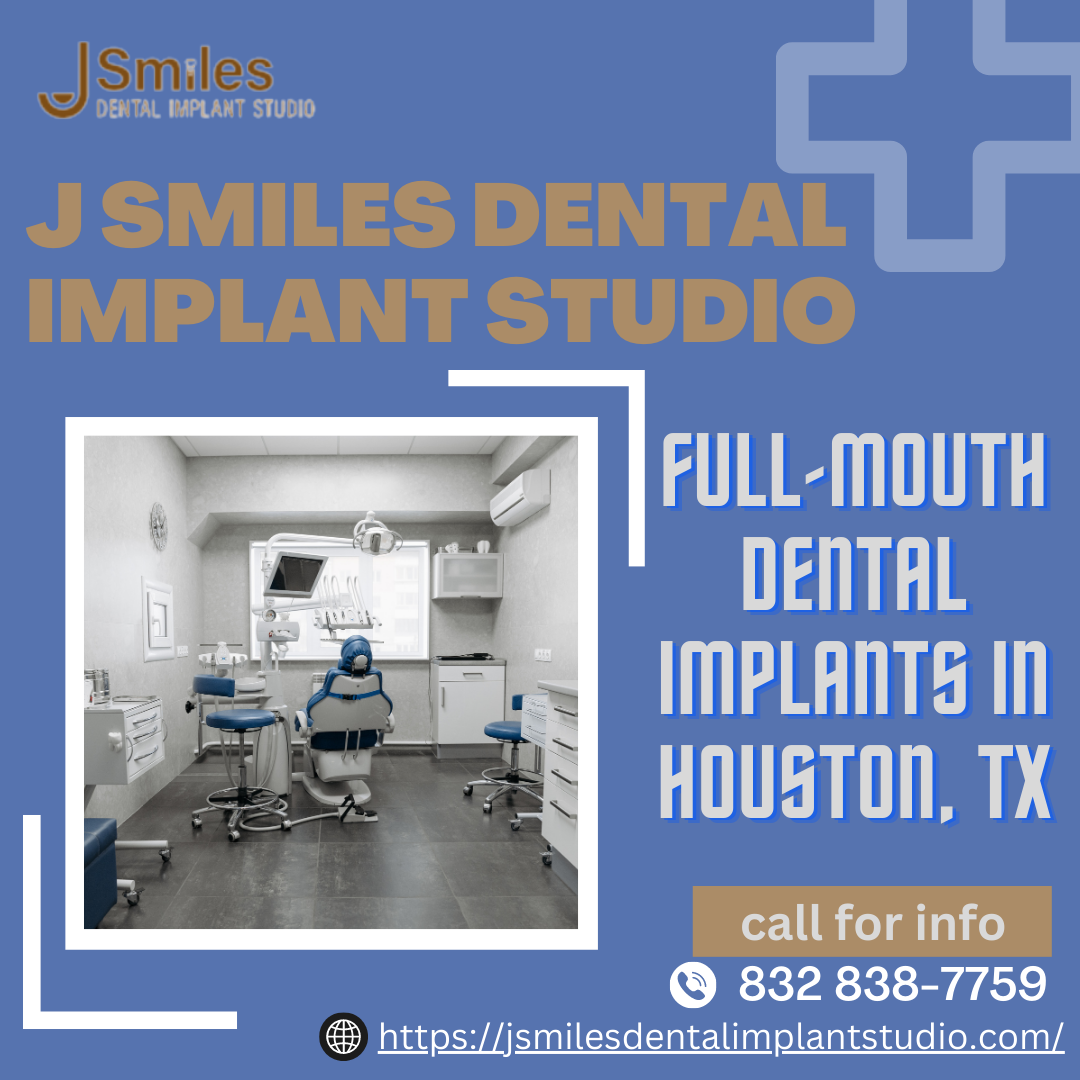 Full-Mouth Dental Implants in Houston, TX — J Smiles Dental Implant Studio - J Smiles Dental ...