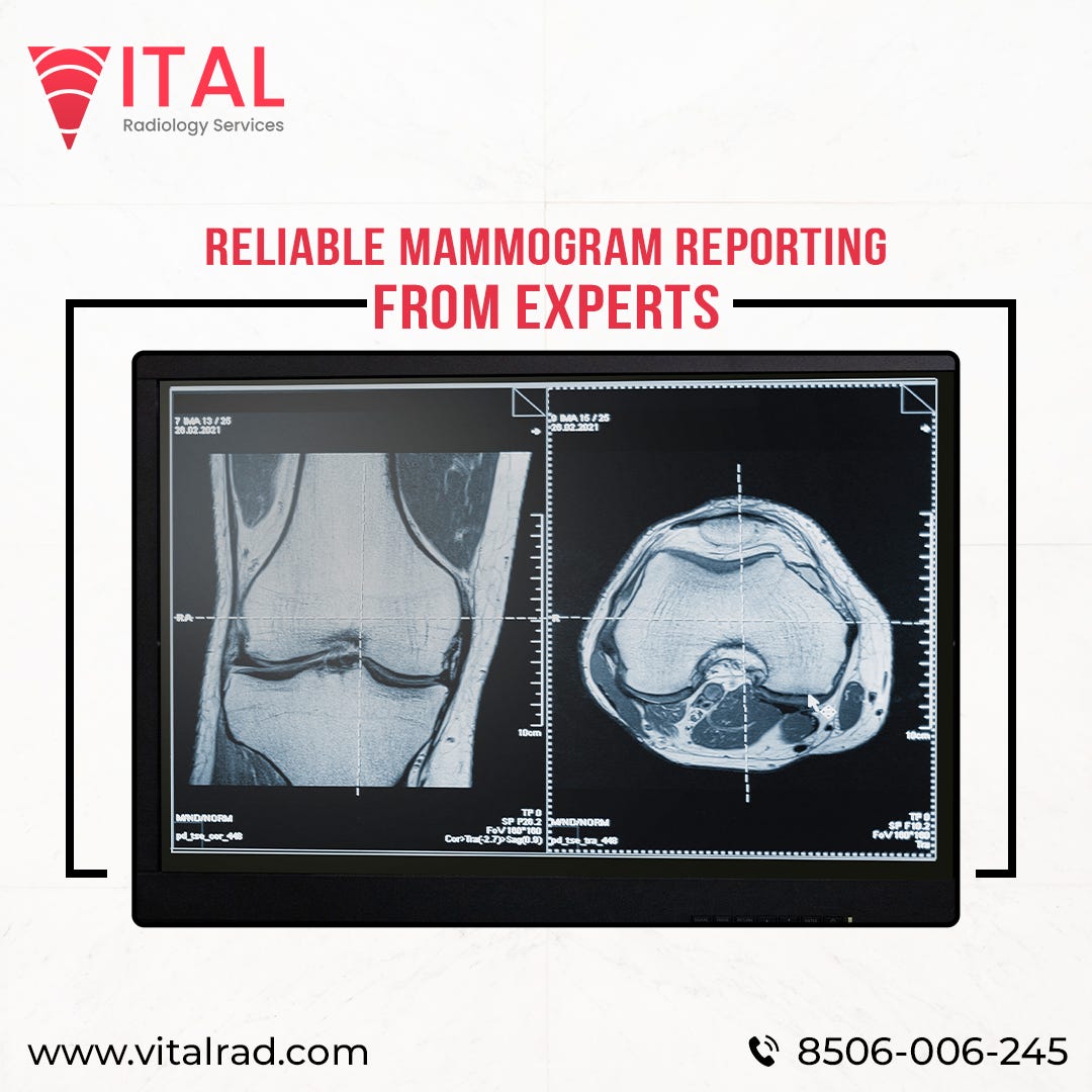 Reliable Mammogram Reporting from Experts - Vitalradindia - Medium