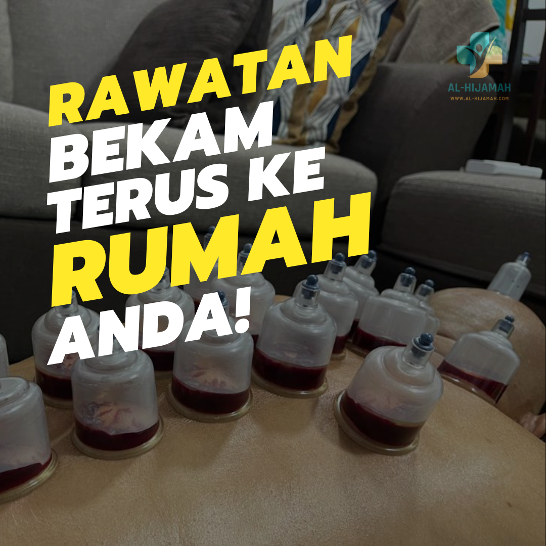 Rawatan Bekam ke Rumah Anda. Terapi bekam ke rumah anda adalah… | by al hijamah | Jul, 2024 | Medium