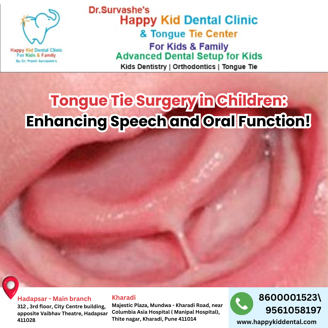Tongue Tie Surgery in Children: Enhancing Speech & Oral Function! | by ...
