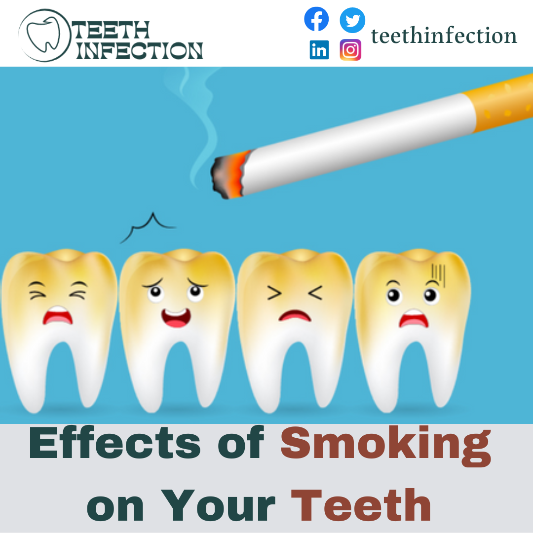 Effects of Smoking on Your Teeth. Smoking can have several negative ...