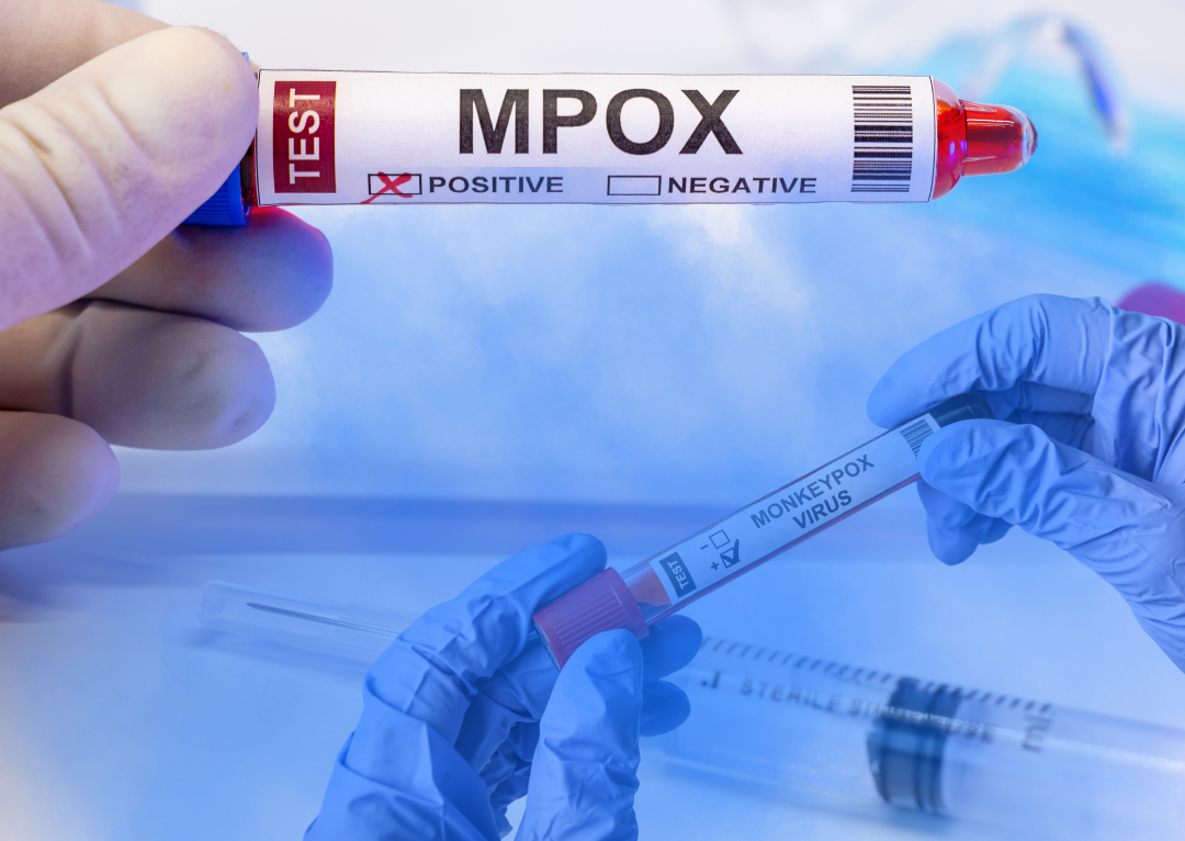 Monkeypox in the Philippines: Should We Be Concerned? | by Cebu ...