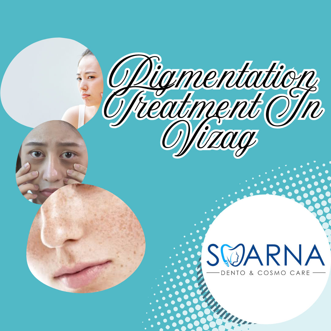Pigmentation Treatment In Vizag | Swarna Cosmo Care | by Swarna Cosmo Care | May, 2025 | Medium