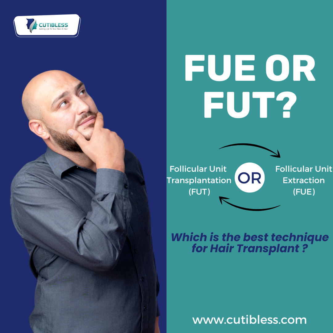 Why Follicular Unit Extraction (FUE) is Preferred Over Follicular Unit ...