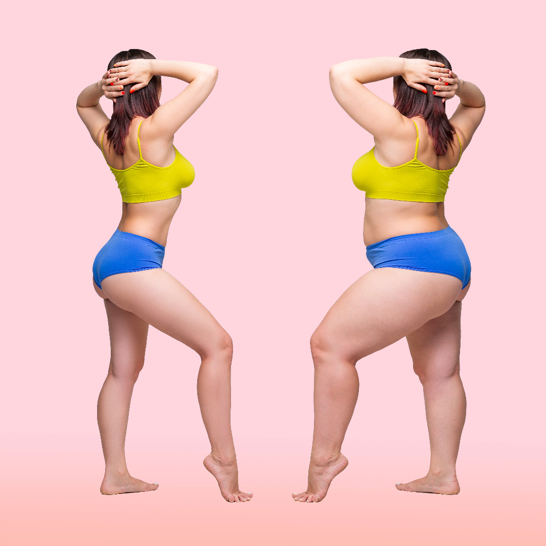 Articles Discussing Obesity Management | by Teja V Surapaneni, MD, MS | YourMD.online | Medium