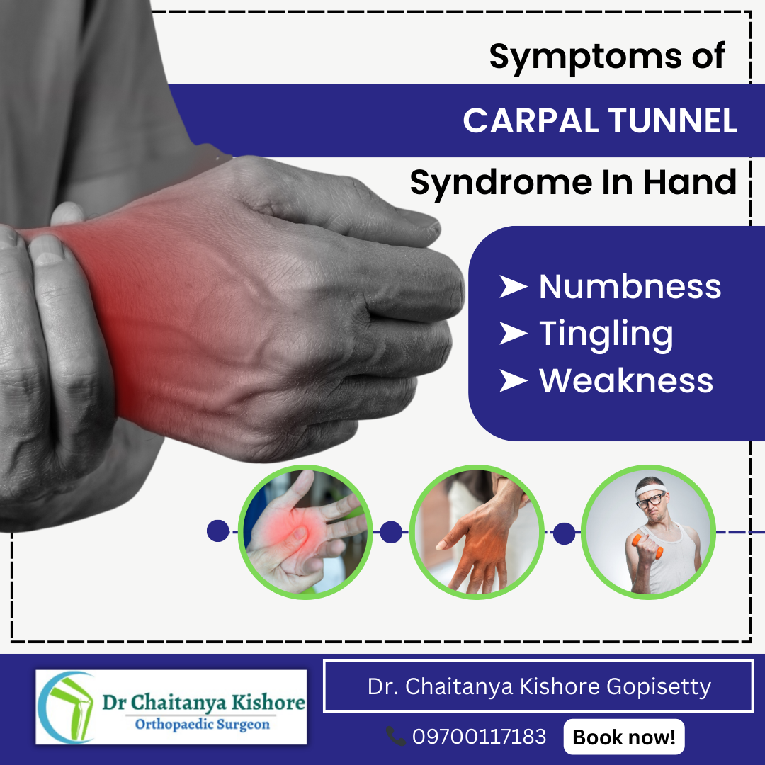 Carpal Tunnel Syndrome (CTS). Carpal Tunnel Syndrome (CTS) is a… | by ...