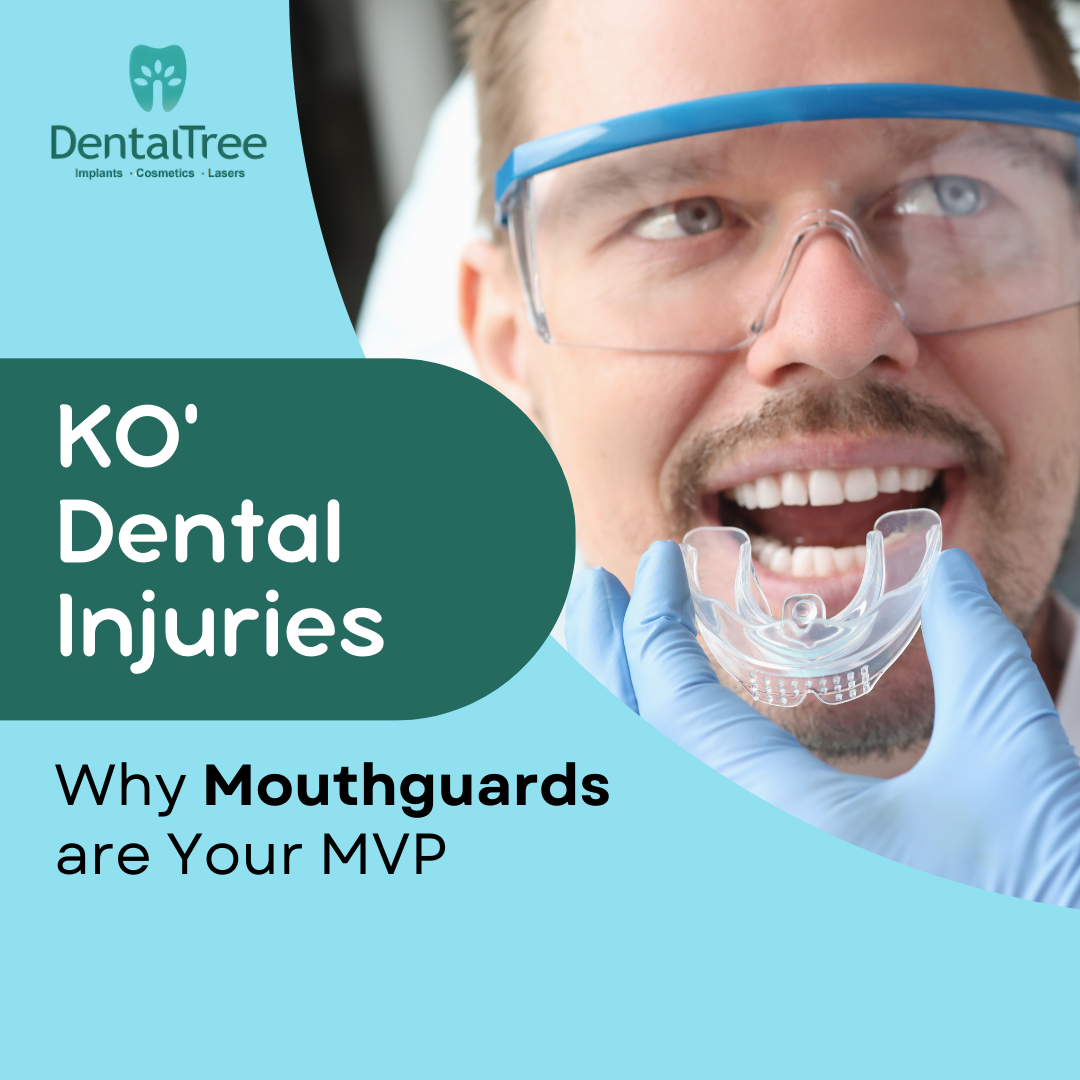 Protect Your Smile: Mouthguards as MVPs for Dental Injuries | Best ...