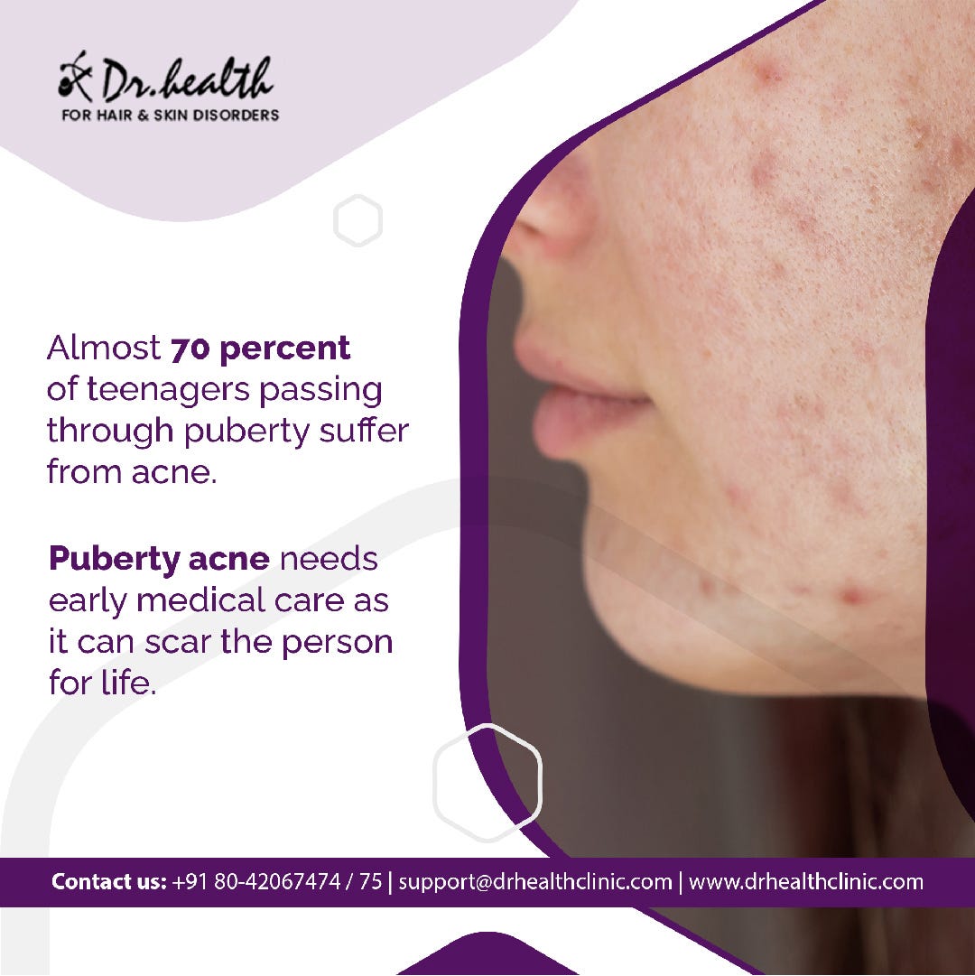 5 Reasons to See a Dermatologist for Acne Treatment | by Drhealthclinic ...