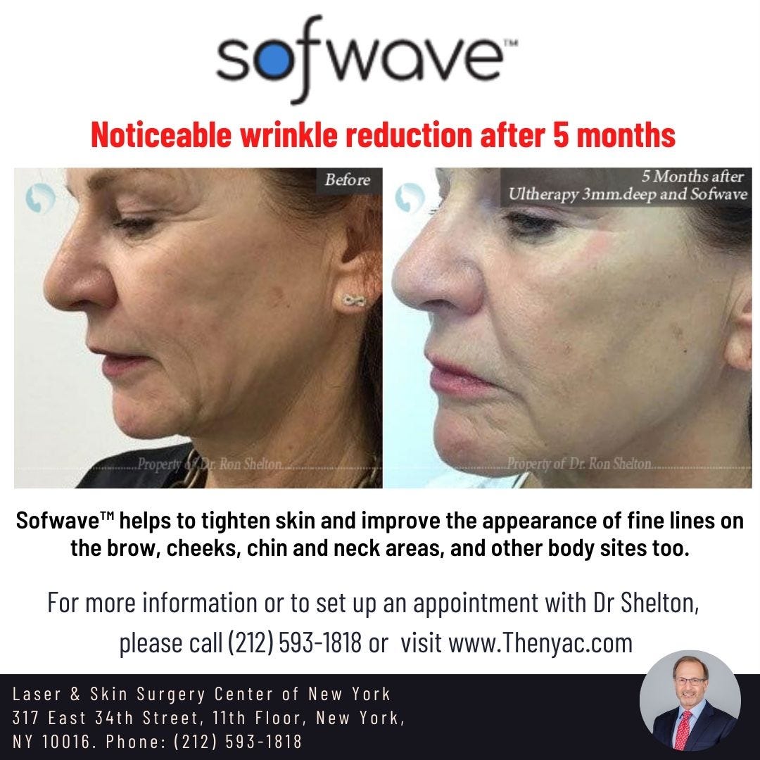 Wrinkle Reduction with Sofwave - Dr. Ronald M Shelton M.D - Medium