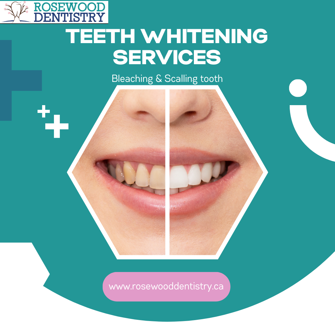 Beyond White: A Comprehensive Approach to Pediatric Dentistry and Teeth ...
