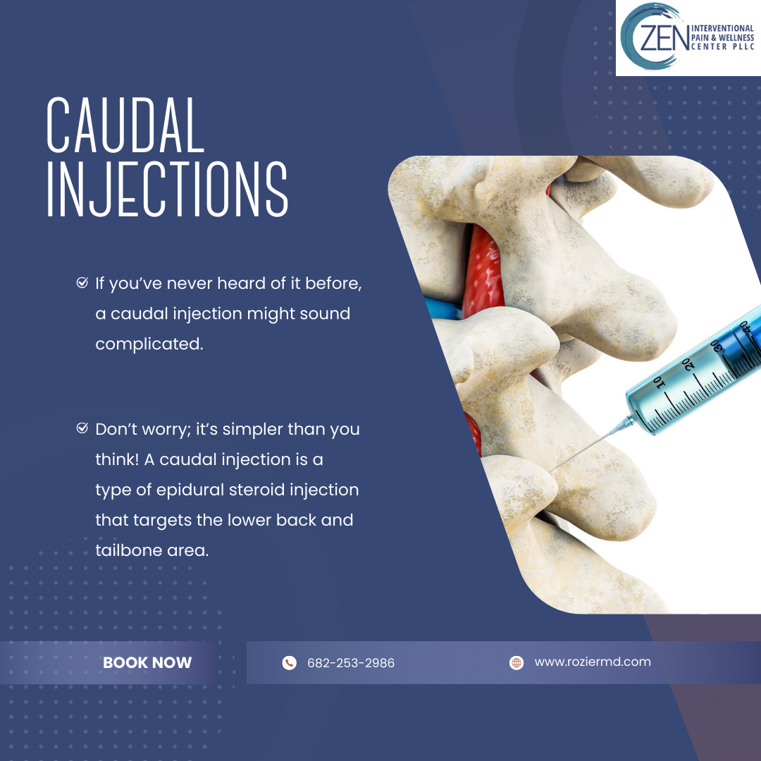 Life-Changing Results: Why Caudal Injections Are Mansfield, TX’s Best ...