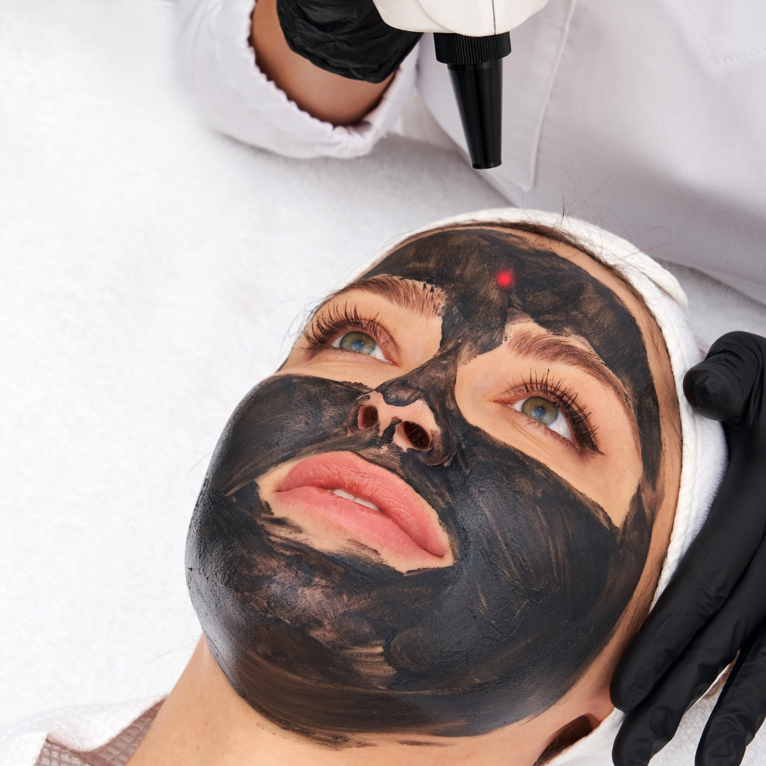 Carbon Peel Technique to Improve Skin Quality | by Digital Lifero | Medium