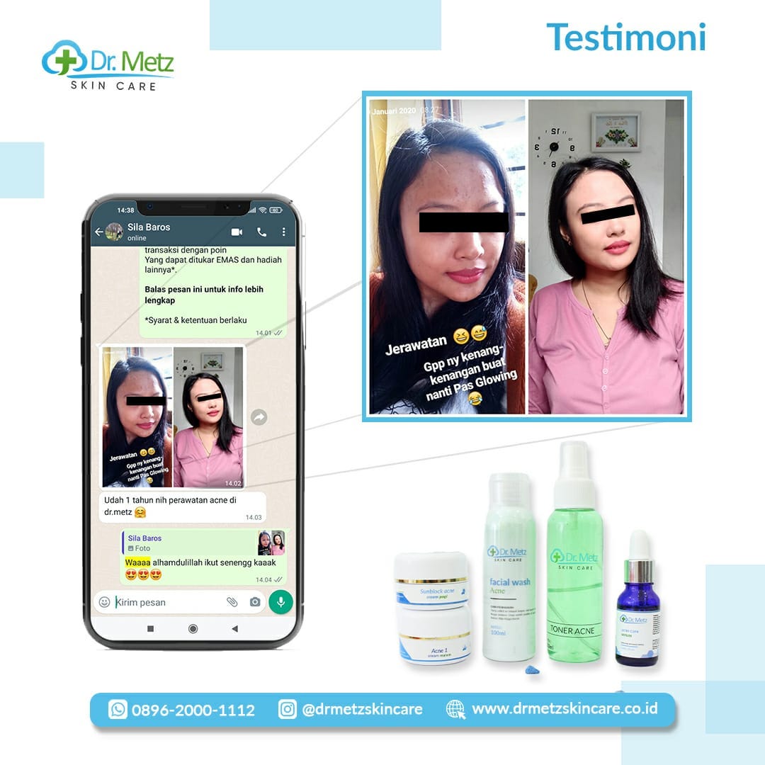 Call 0896–2000–1112 Dokter Muka Untuk Jerawat Di Sukabumi | by ...
