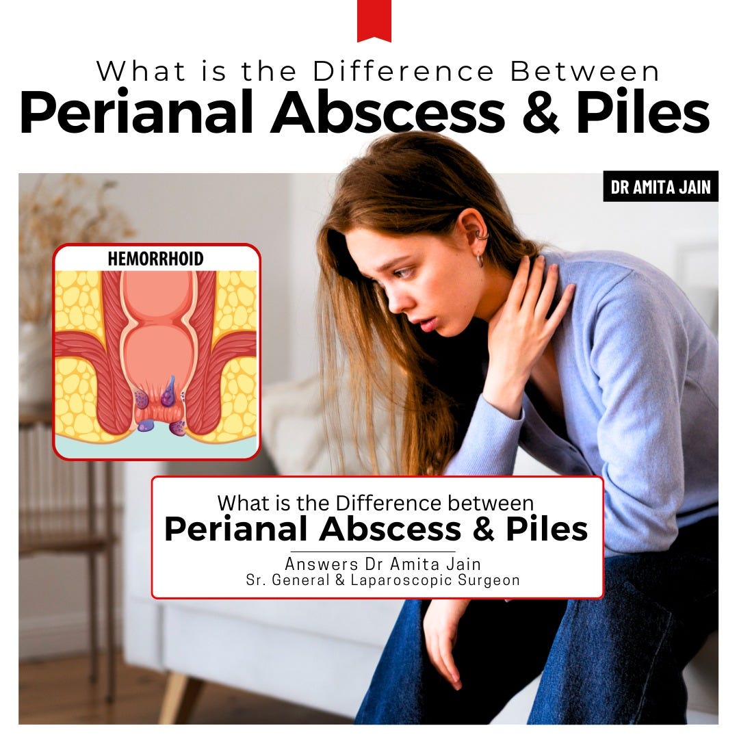 What is the Difference Between Perianal Abscess and Piles? | by Dr ...