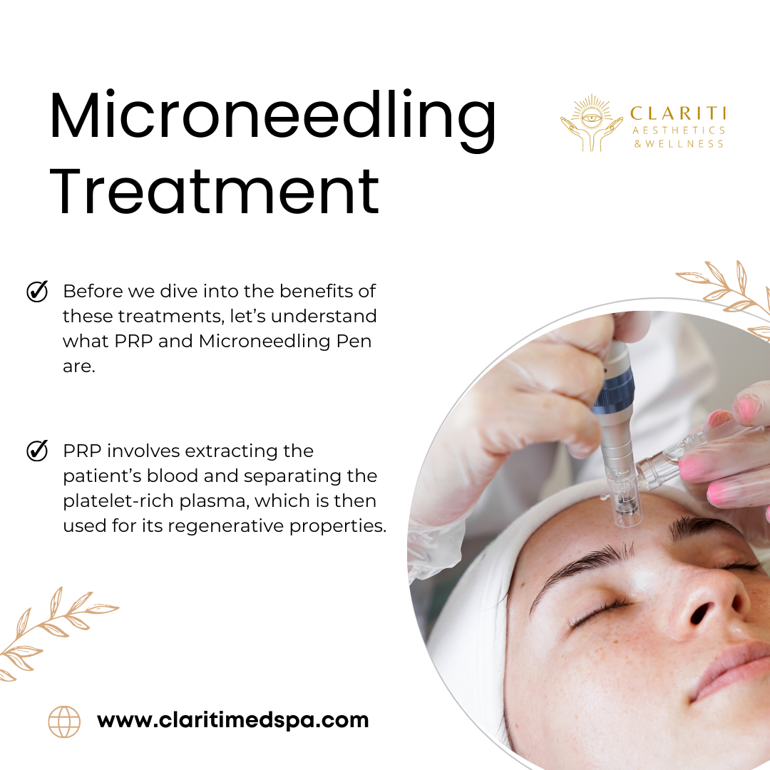 Get Glowing Skin with PRP and Microneedling Pen in Houston, TX | by ...