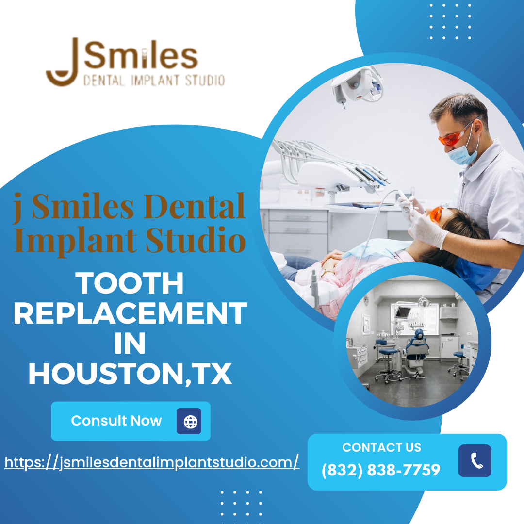 Tooth Replacement Houston,TX — J Smiles Dental Implant Studio - J Smiles Dental Implant Studio ...