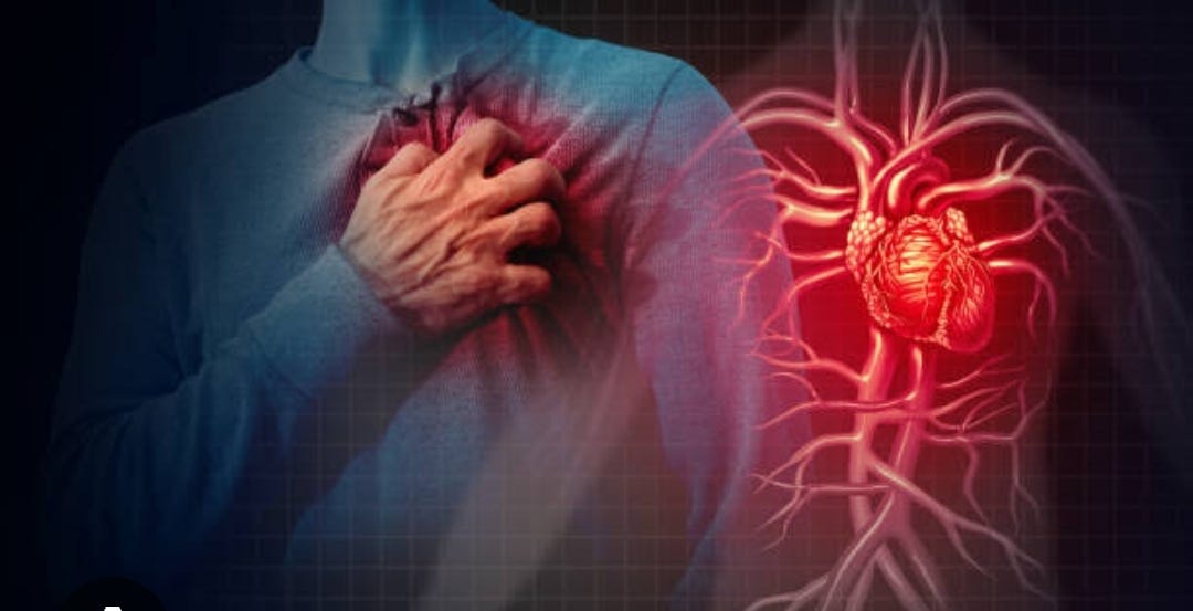 Here’s a comprehensive article on heart attack: | by anza | Dec, 2024 ...