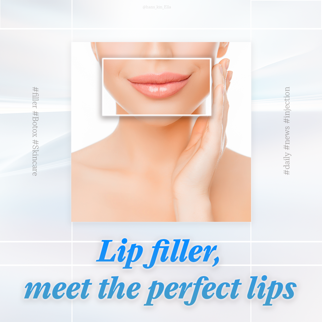 Lip filler meets the perfect lips | by Ella | Medium