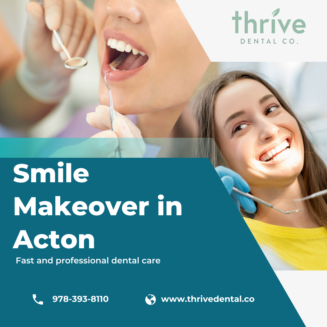 Smile Makeover in acton - Thrive dental - Medium
