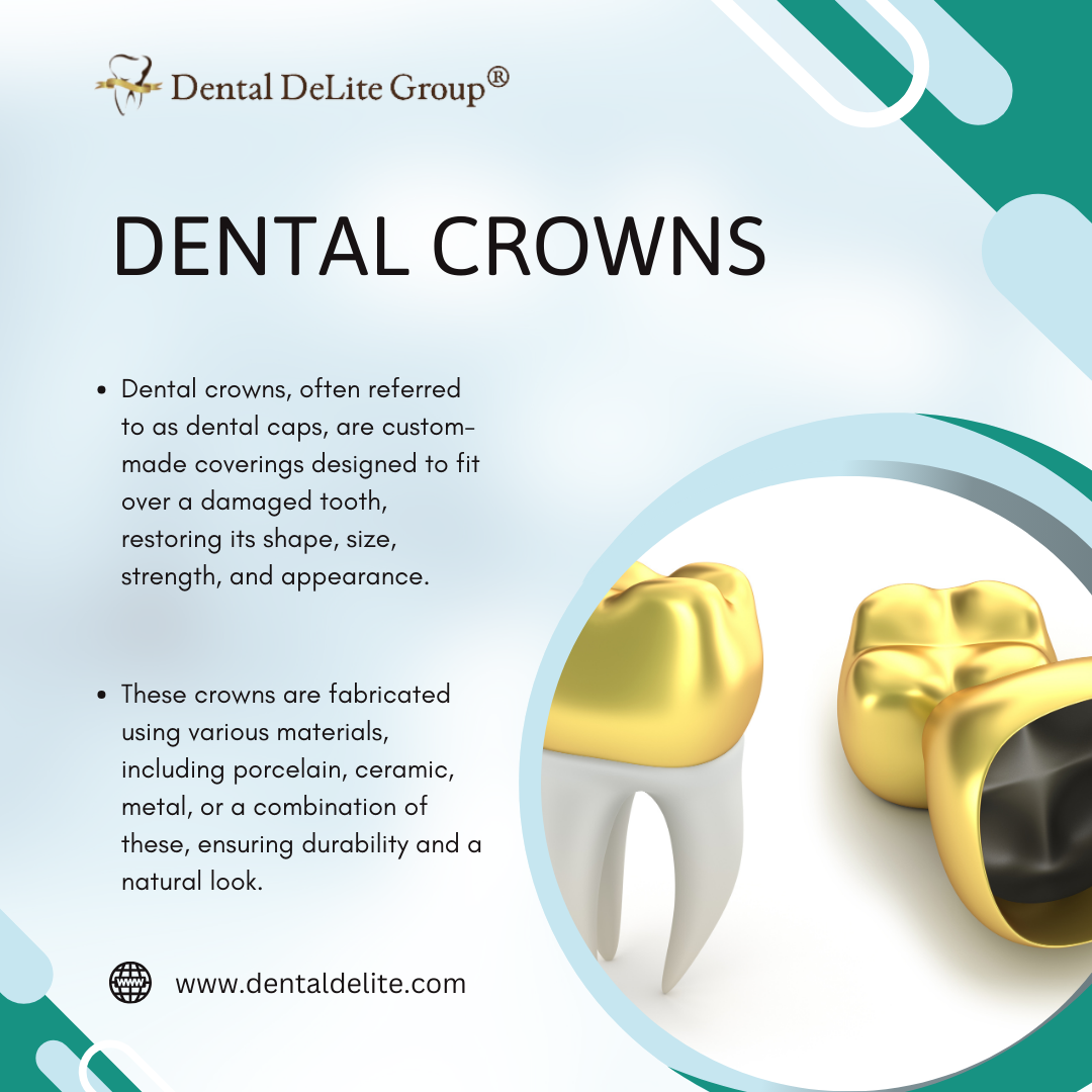 Transform Your Smile with High-Quality Dental Crowns in Dallas and ...