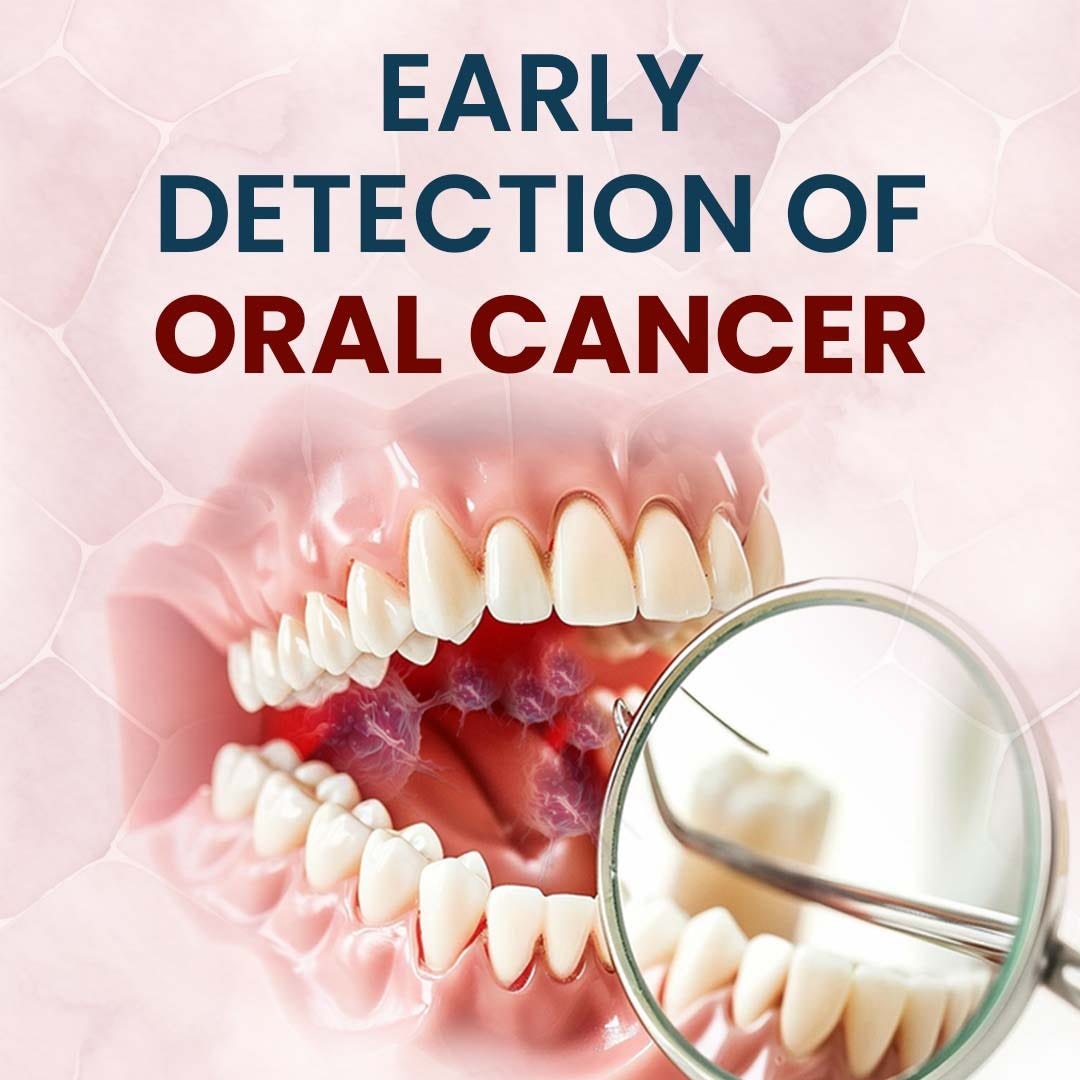 Early Detection of Oral Cancer. The early detection of oral cancer is a ...