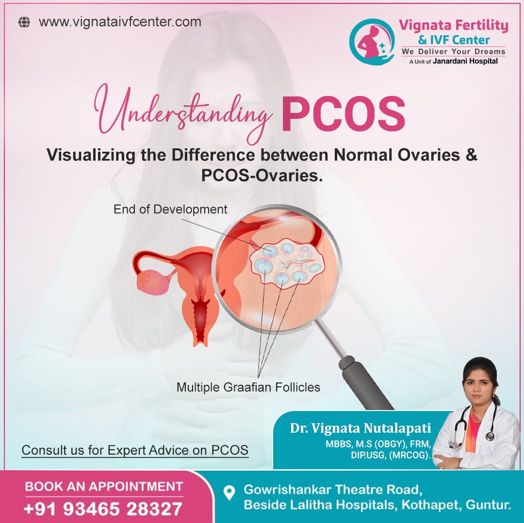 Best Infertility Doctor in Guntur: Understanding PCOS and the ...