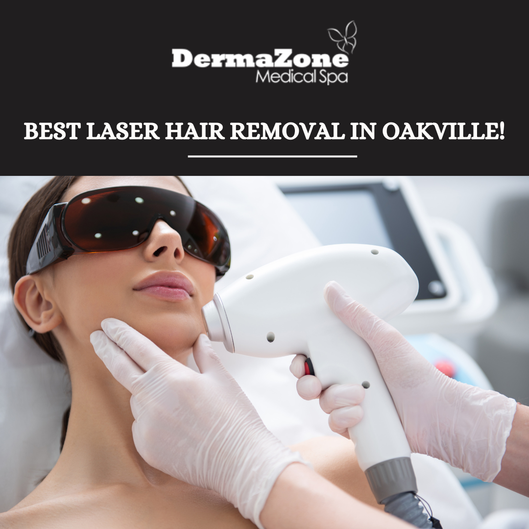 Best Laser Hair Removal Services in Oakville! - DermaZone - Medium