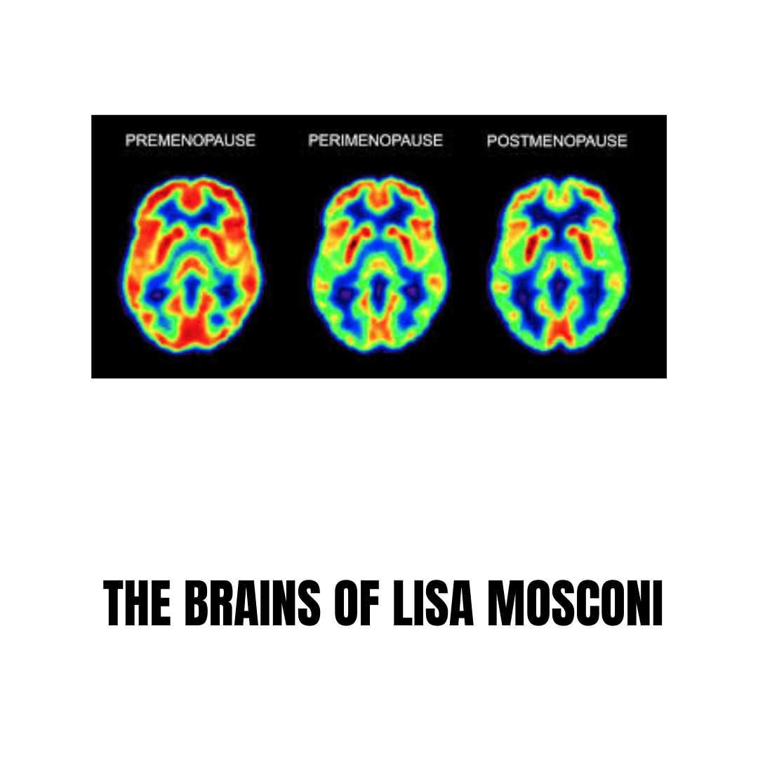 The Brains of Lisa Mosconi. TED speaker, Author, Neuroscientist | by ...