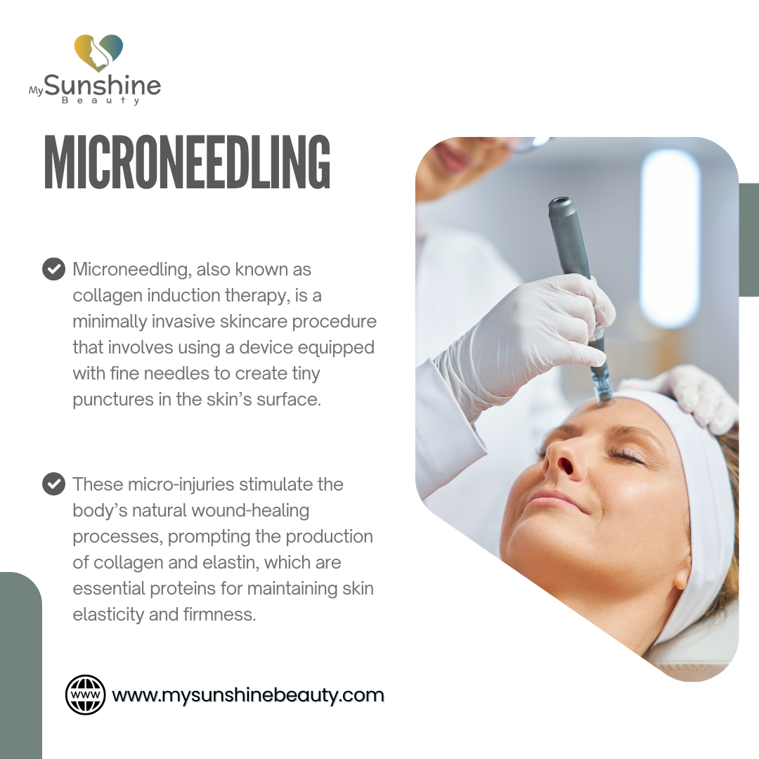 Rejuvenate Your Skin Naturally with Microneedling and Stem Cell Therapy ...